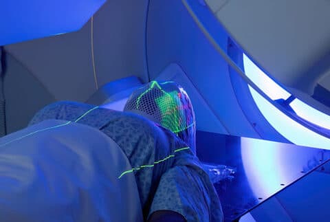 High resolution lens for radiotherapy - Resolve Optics